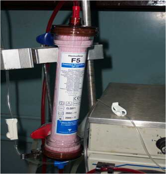 Hemodialysis – Sapiens Health Foundation